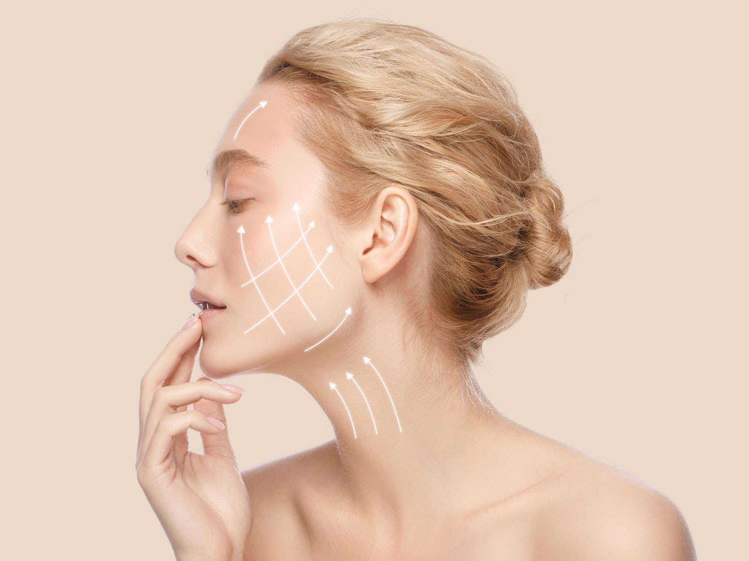 BioThreads®️ - Fios Faciais e Bioestimuladores - Instituto Diogo Lustosa